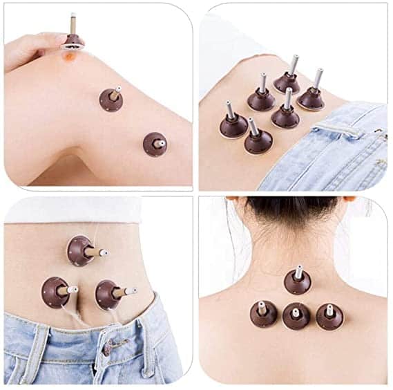 Mini Moxa Sticker Candle for acupuncture point massager Set-20 ...
